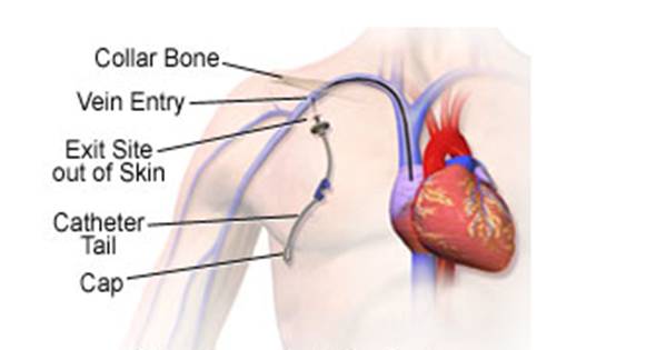 Part 5 Common ICD 10 Coding Errors